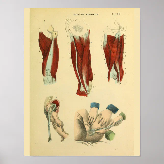 Poster Thigh Muscles Birth Forceps Anatomy Art Print | Zazzle.fr