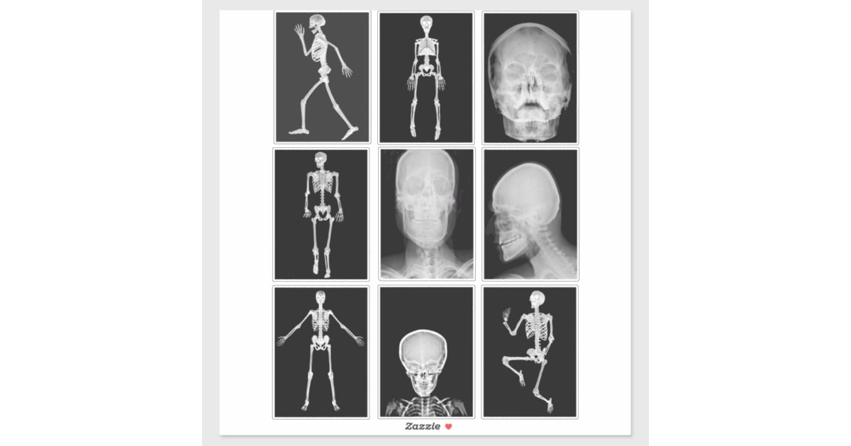 Sticker squelette Crâne corps humain XRAYS Collage feuille | Zazzle.fr